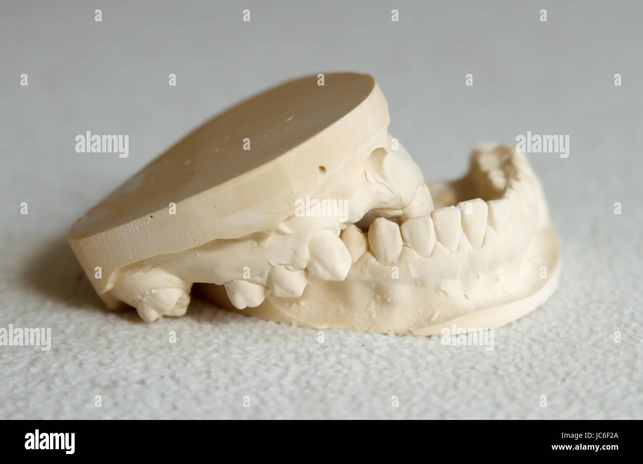 Dental gypsum model mould of teeth in plaster Stock Photo - Alamy