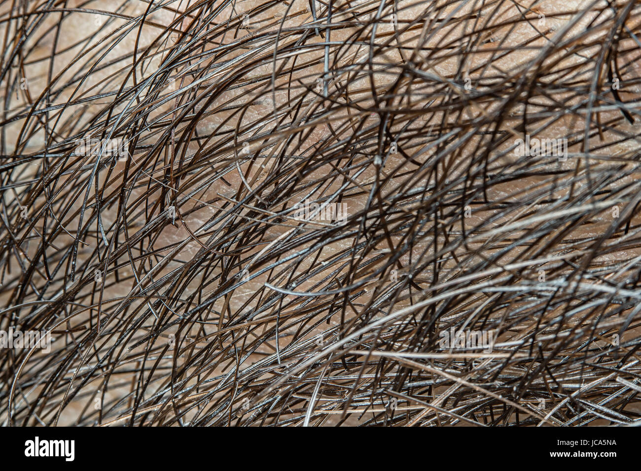 Human male skin with beard hair super close-up view. Magnification ...