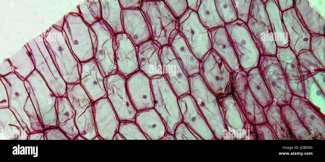 Onion cell micrograph hi-res stock photography and images - Alamy