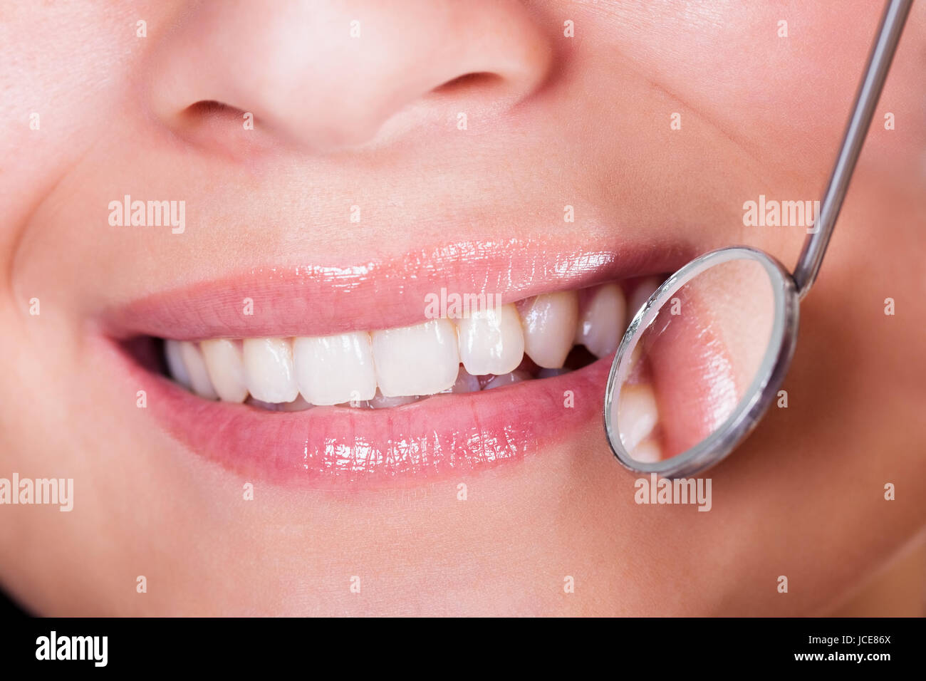 Cropped closeup of the mouth of a smiling woman with perfect teeth with ...