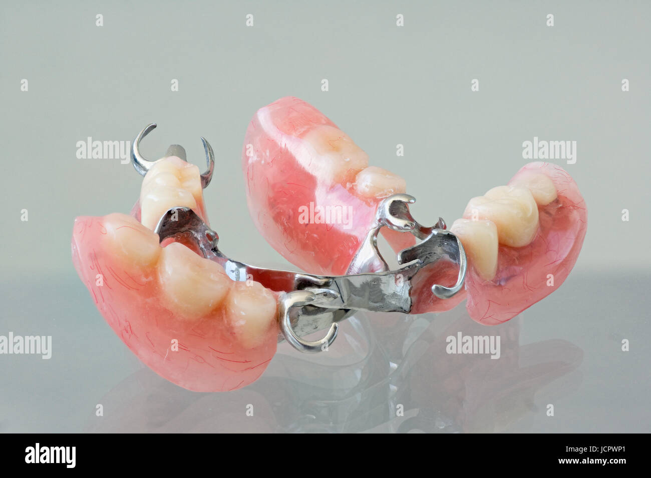 Clasp denture with a metal arc and artificial teeth Stock Photo - Alamy