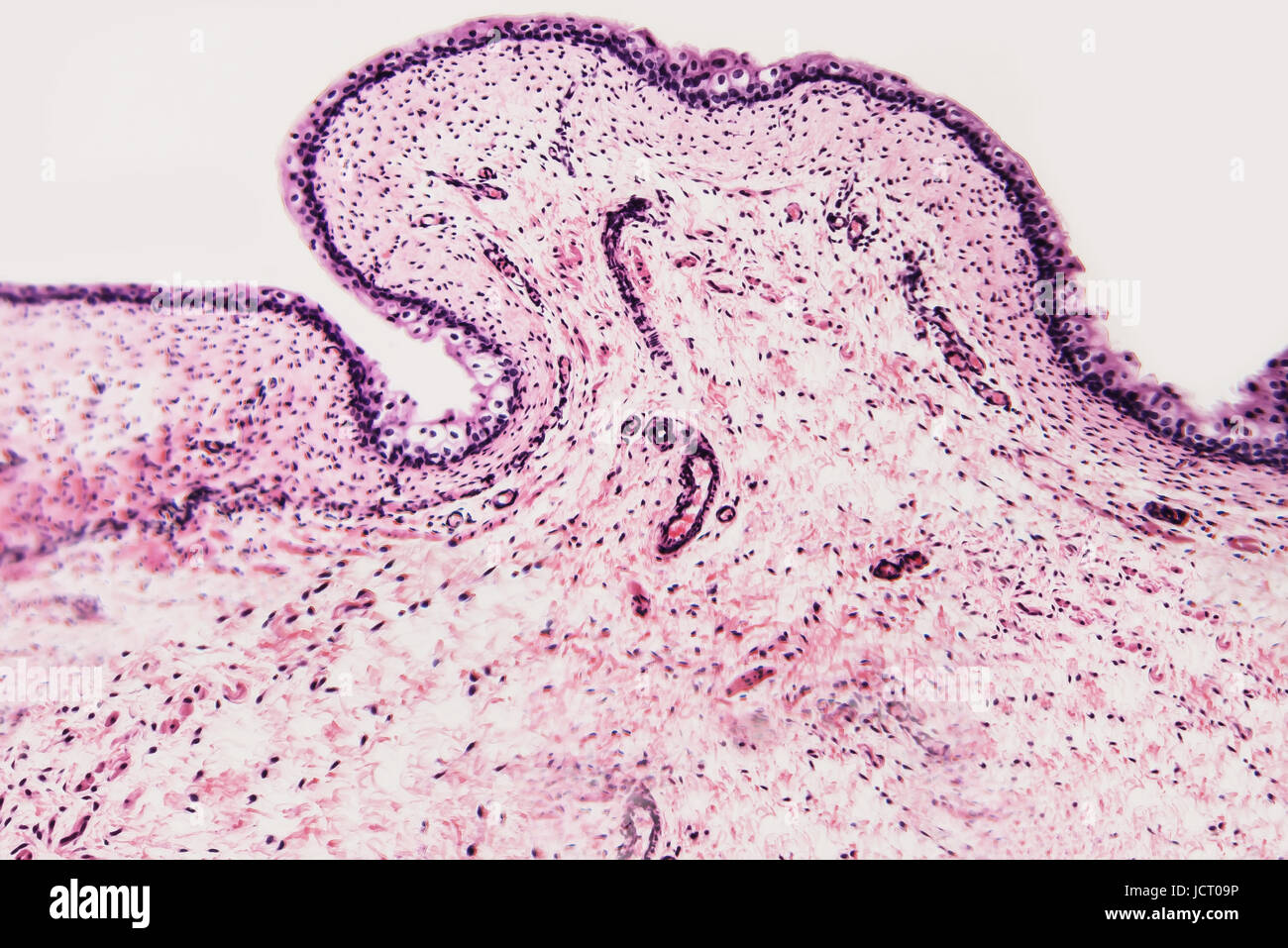 Urinary bladder microscope hi-res stock photography and images - Alamy