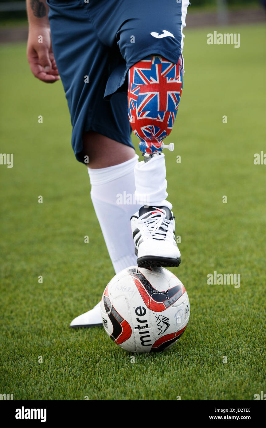 Andy Bell with his Union Jack prosthetic leg, from Scotlandâ€™s ...