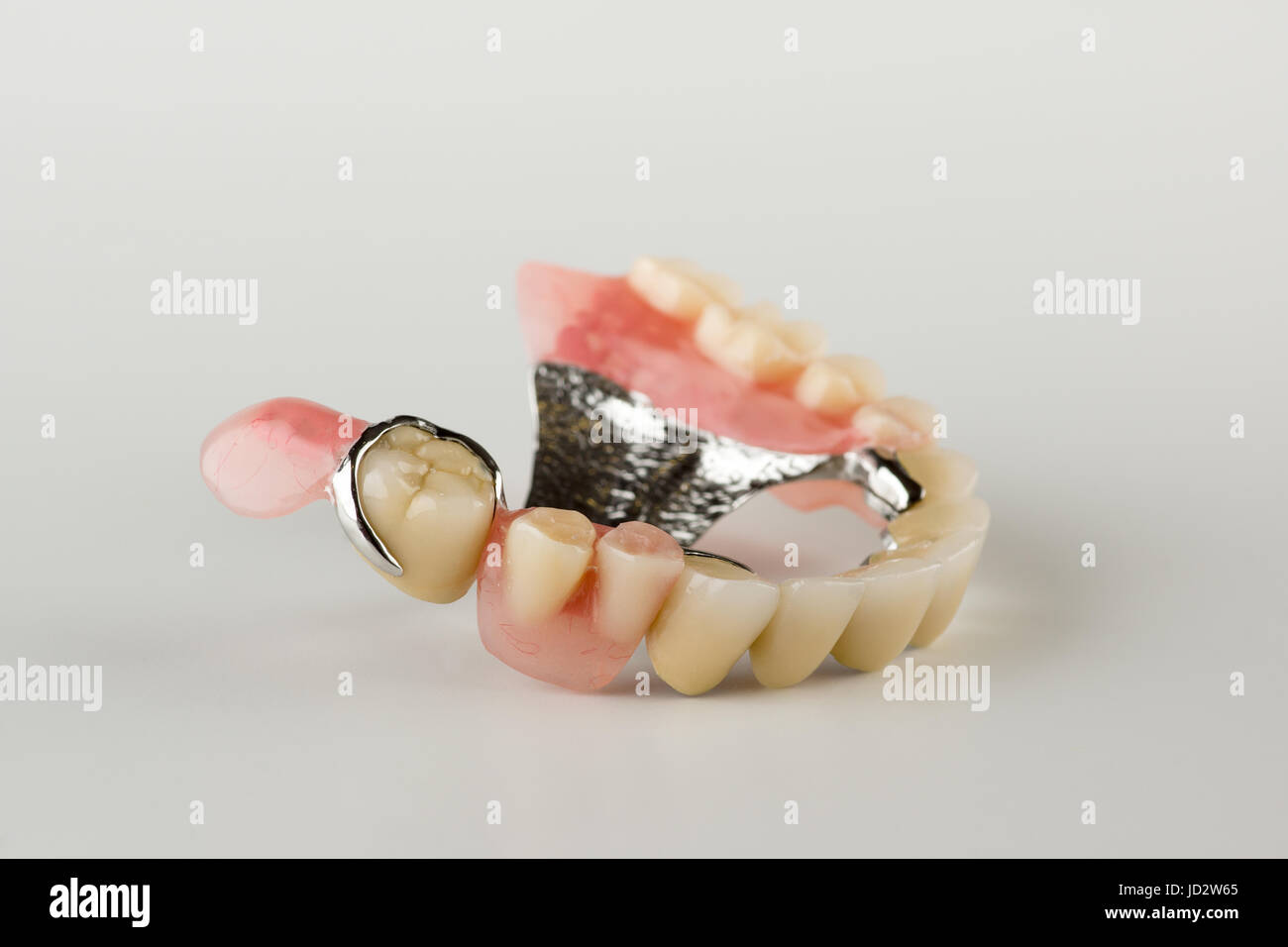 Clasp prosthesis with lock fixation on a white background Stock Photo ...