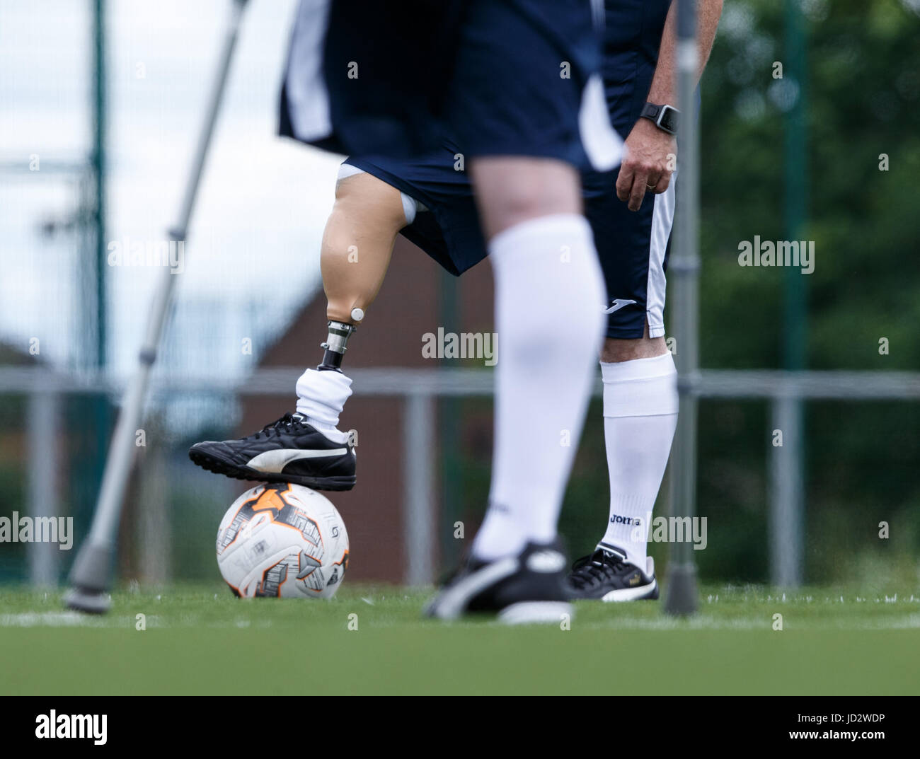 Andy Bell with his Union Jack prosthetic leg, from Scotland's national ...