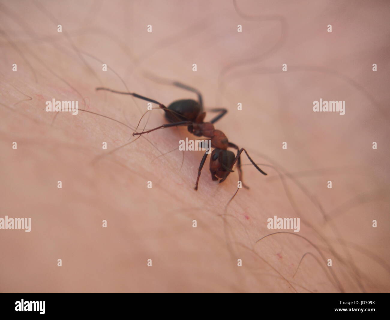 Ant bites skin hi-res stock photography and images - Alamy