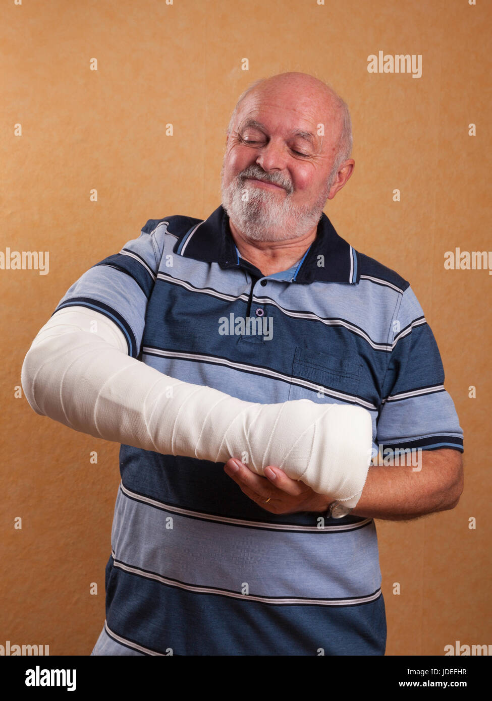 Man with arm in plaster Stock Photo - Alamy
