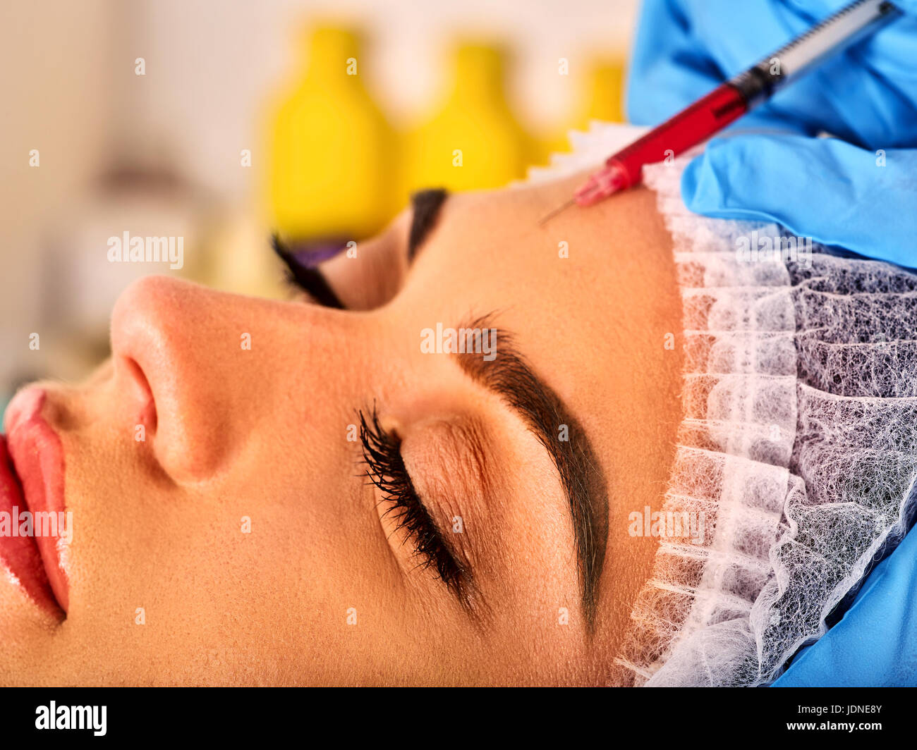 Filler injection for forehead face. Plastic aesthetic facial surgery ...