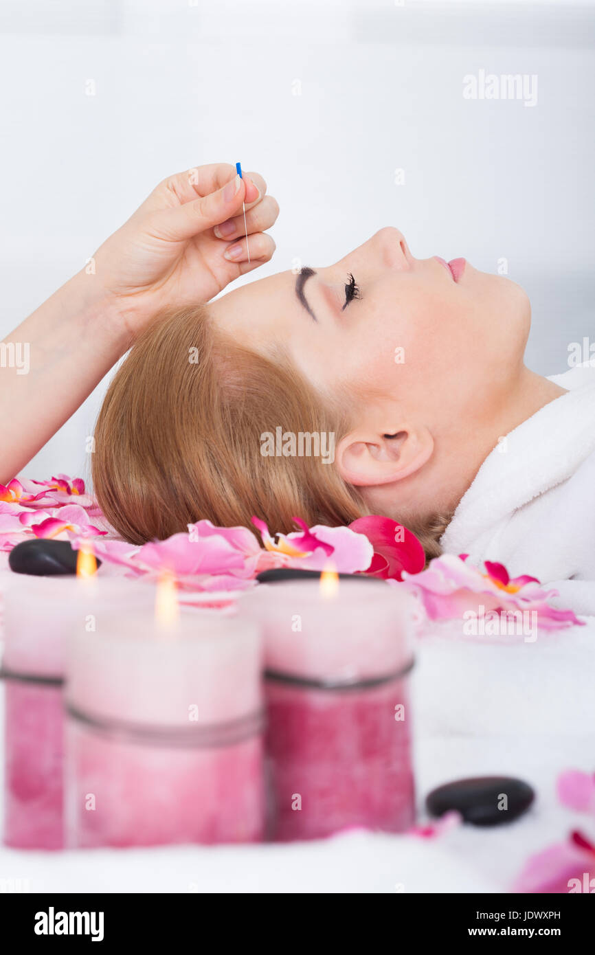 Close-up Of A Young Woman Getting Acupuncture Treatment Stock Photo - Alamy