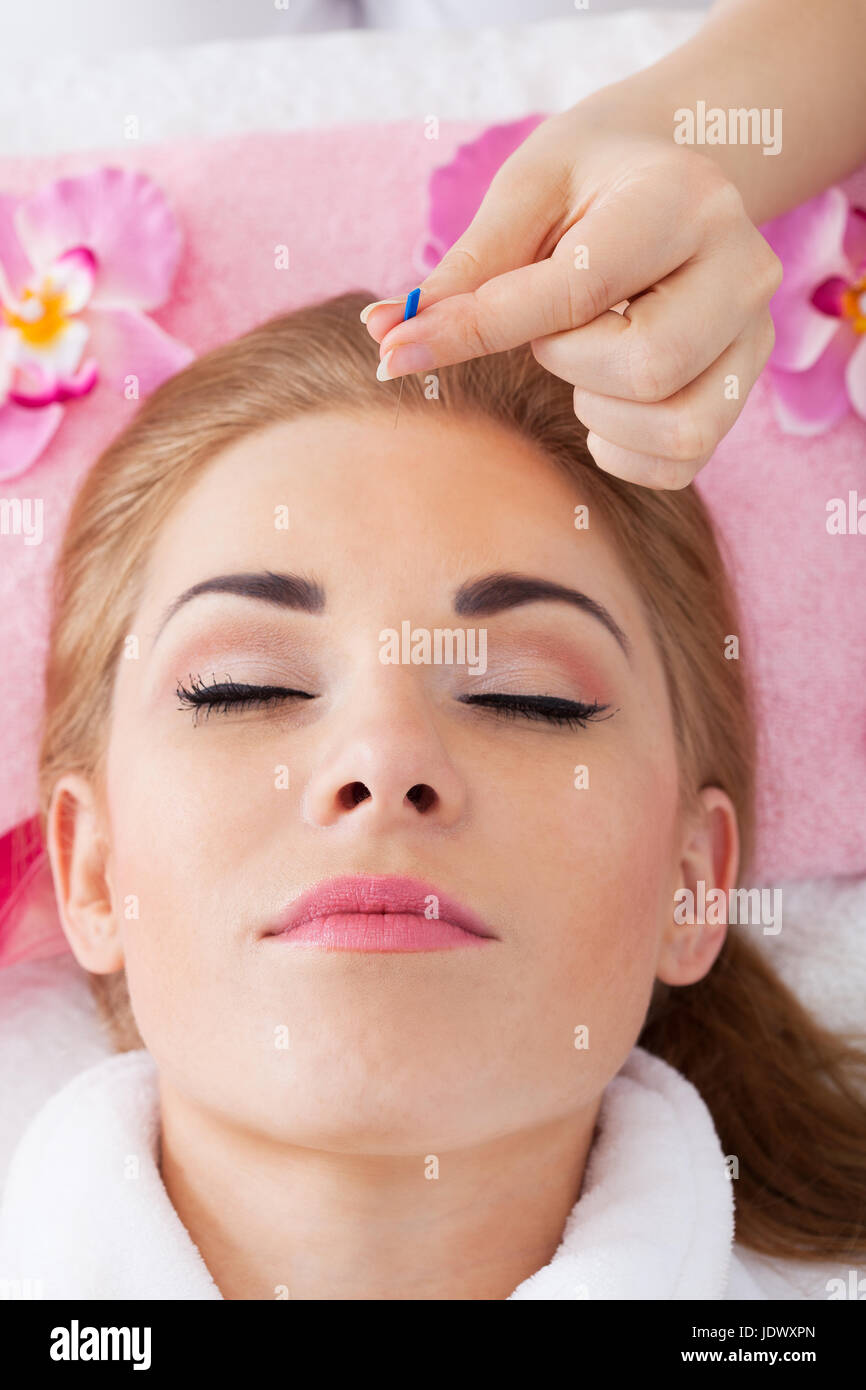 Close-up Of A Young Woman Getting Acupuncture Treatment Stock Photo - Alamy