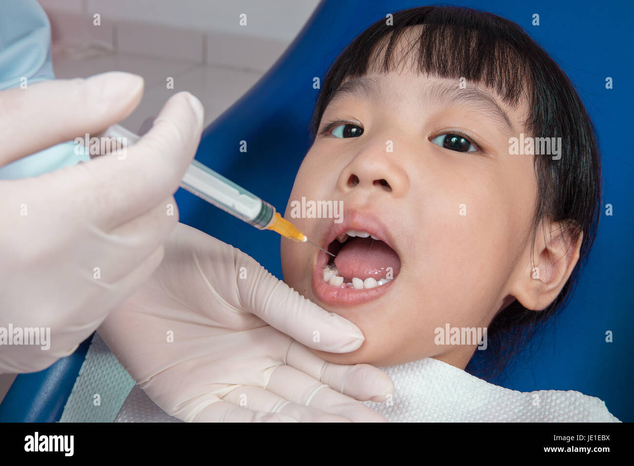 Asian Chinese little girl lying down for tooth extraction at dental ...