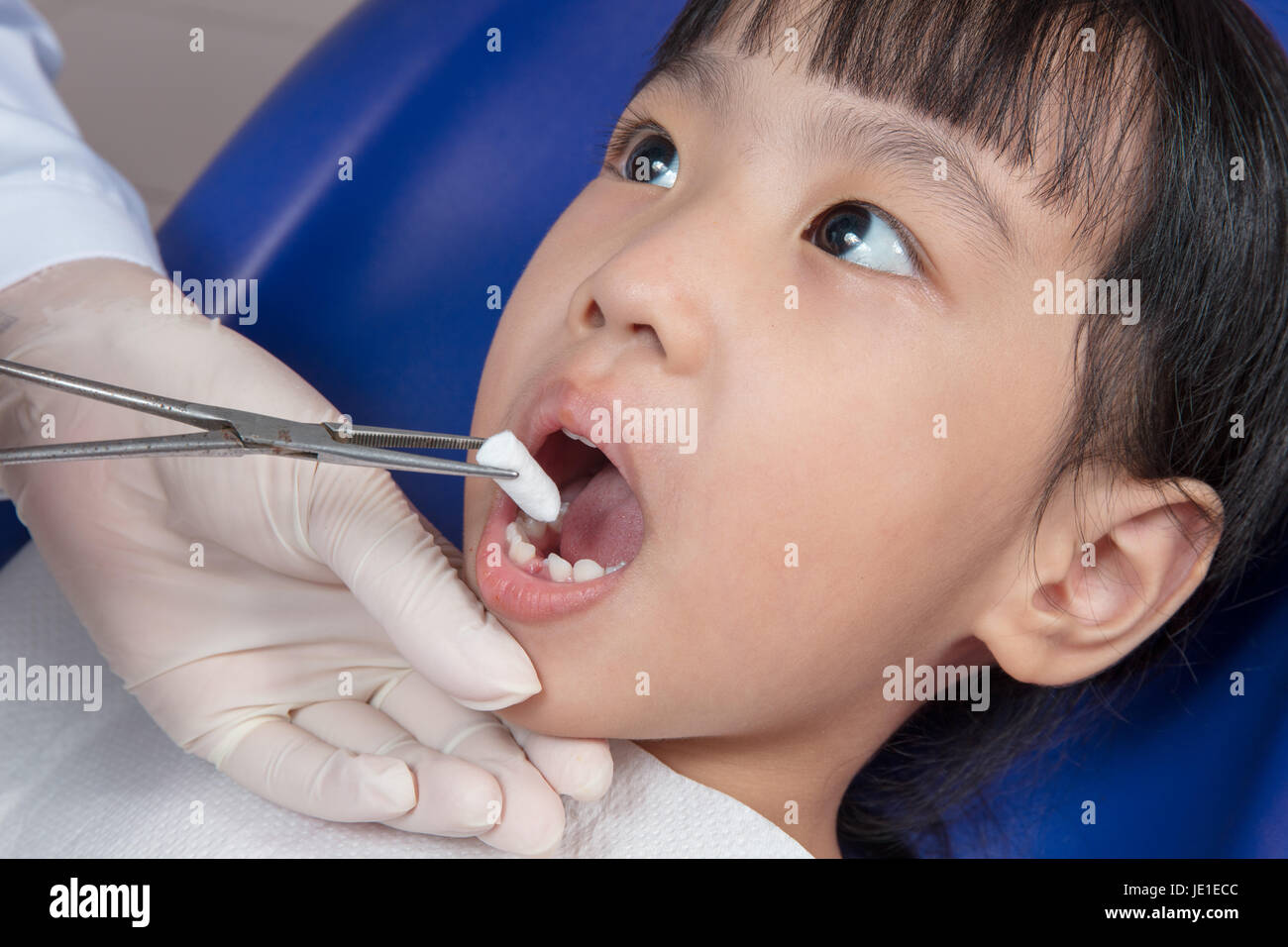 Asian Chinese little girl lying down for tooth extraction at dental ...