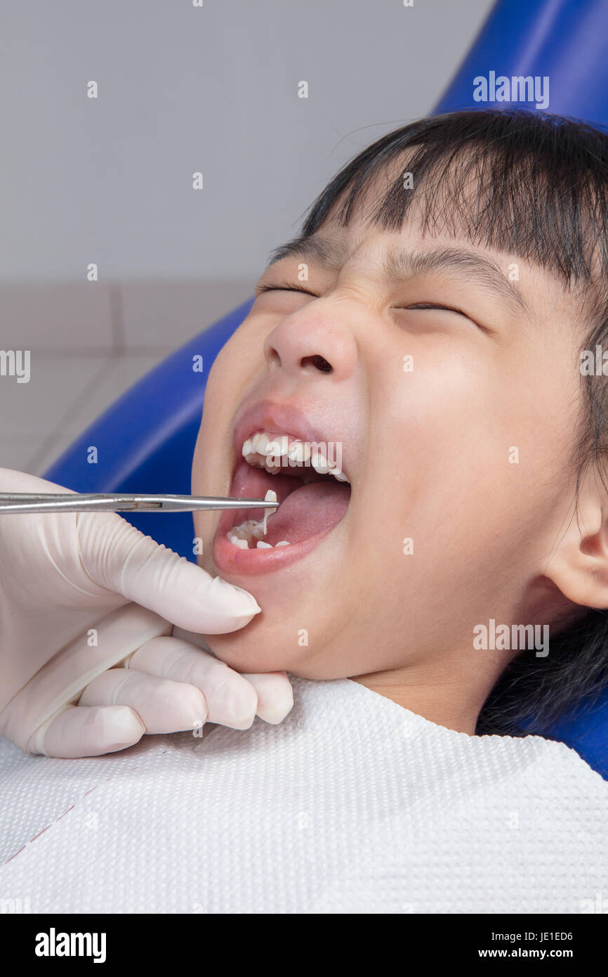Asian Chinese little girl lying down for tooth extraction at dental ...