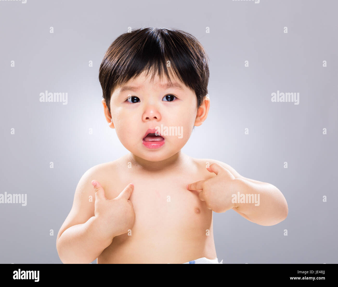 Baby with skin problem Stock Photo - Alamy