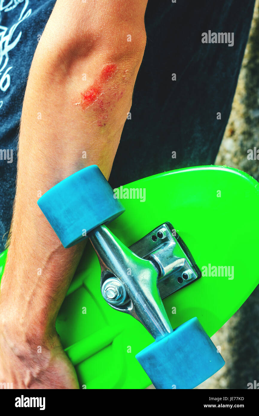 Skateboard injuries hi-res stock photography and images - Alamy