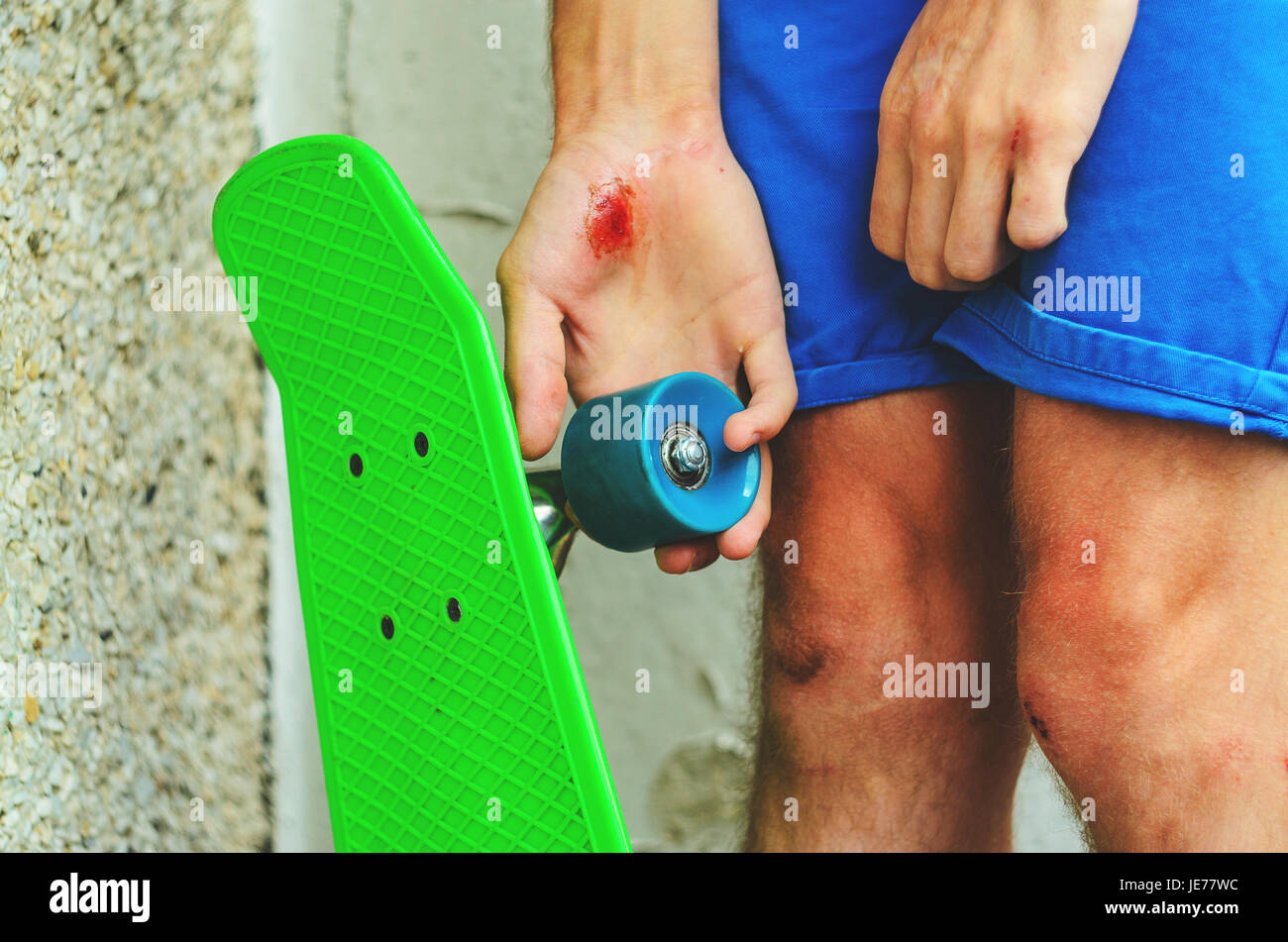 Skateboard injuries hi-res stock photography and images - Alamy