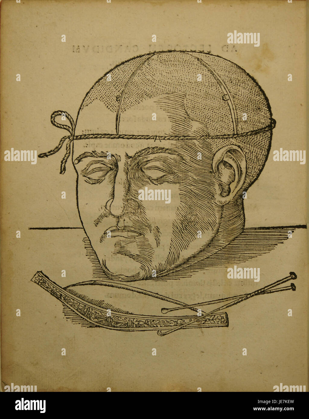 This refers to the early part of 'Anatomiae,' a work by the Swedish ...