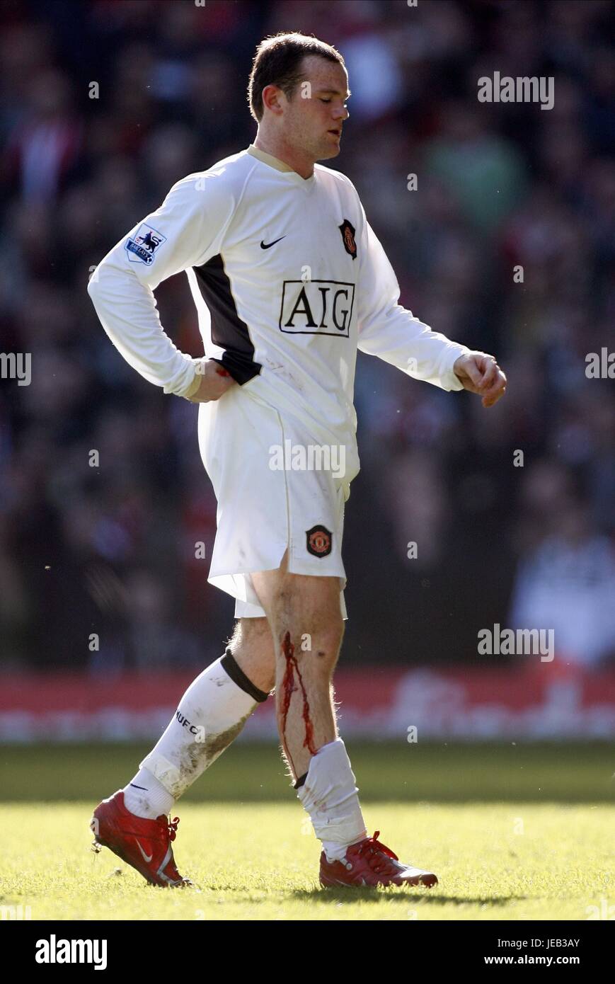 WAYNE ROONEY WITH GASHED LEG, LIVERPOOL V MANCHESTER UNITED, LIVERPOOL ...