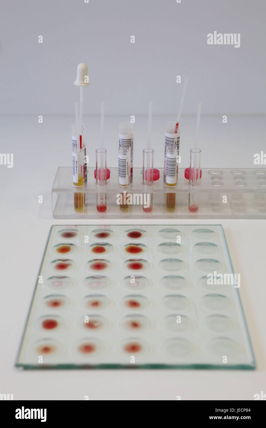 Antigen blood test hi-res stock photography and images - Alamy