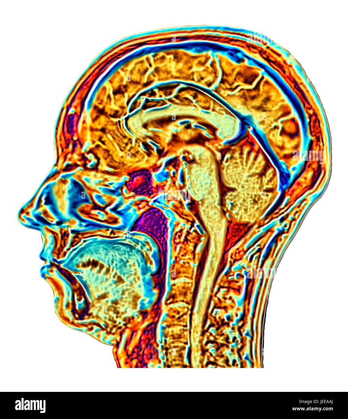 Sagittal view hi-res stock photography and images - Alamy