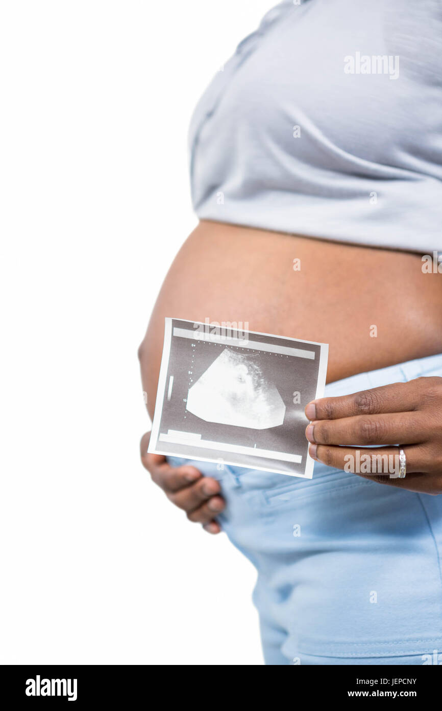 Photograph and scan hi-res stock photography and images - Alamy