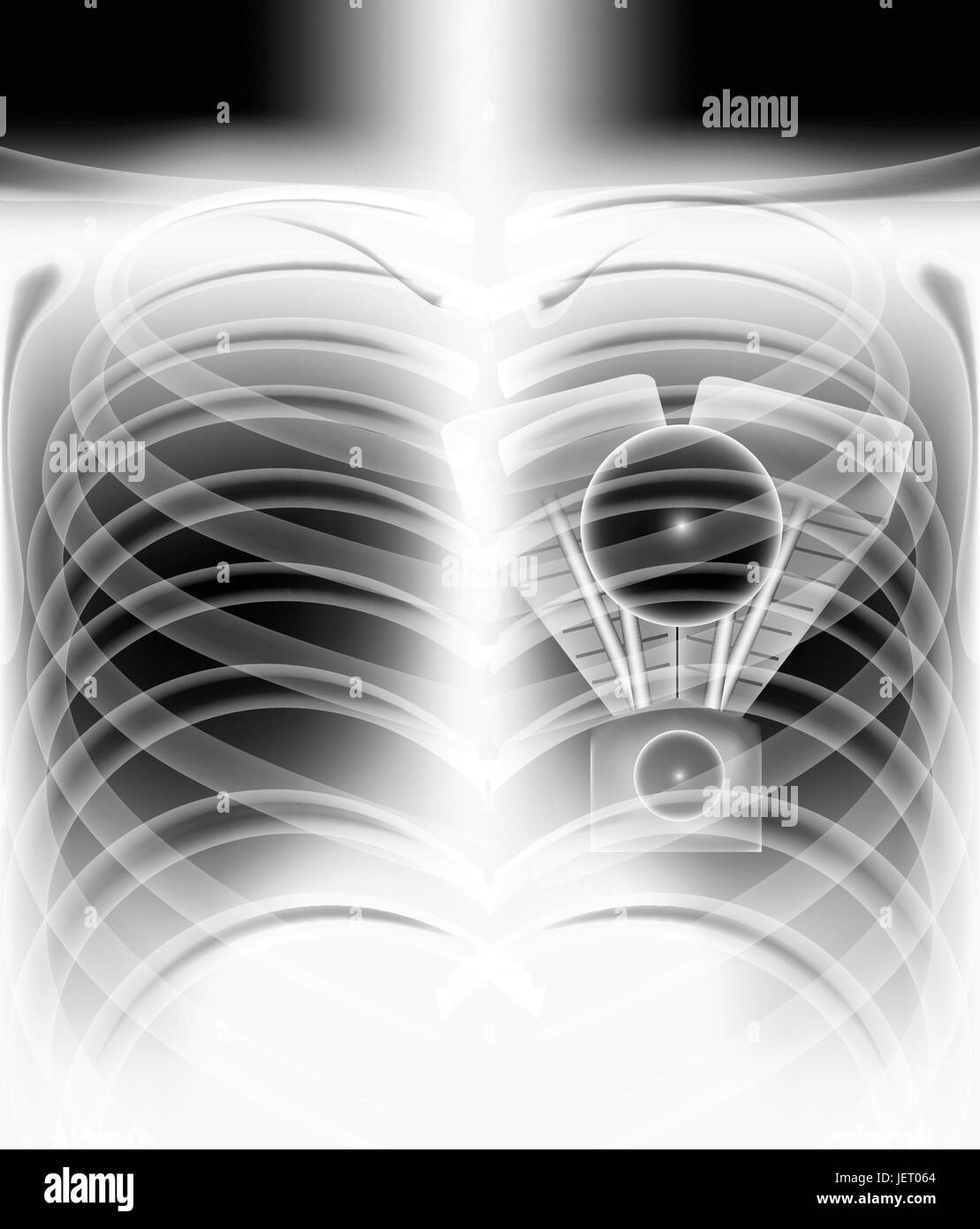 X ray engine Stock Vector Images - Alamy