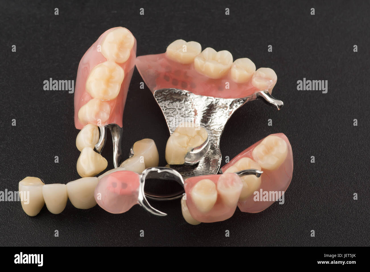 Clasp prosthesis with lock fixation on a black background Stock Photo ...