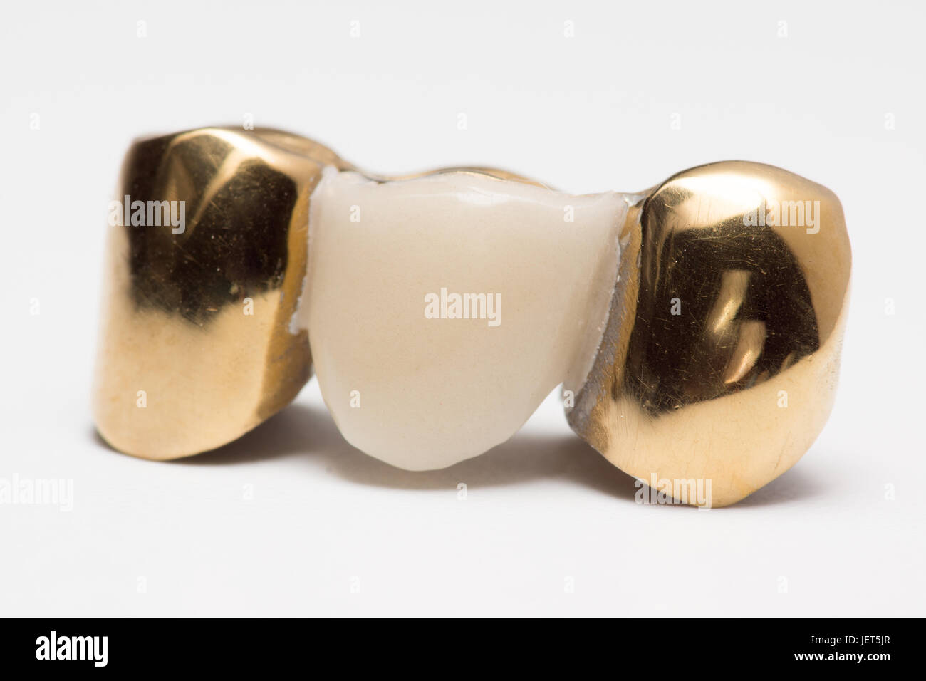 Steel artificial dental crown for dentition restoration Stock Photo - Alamy