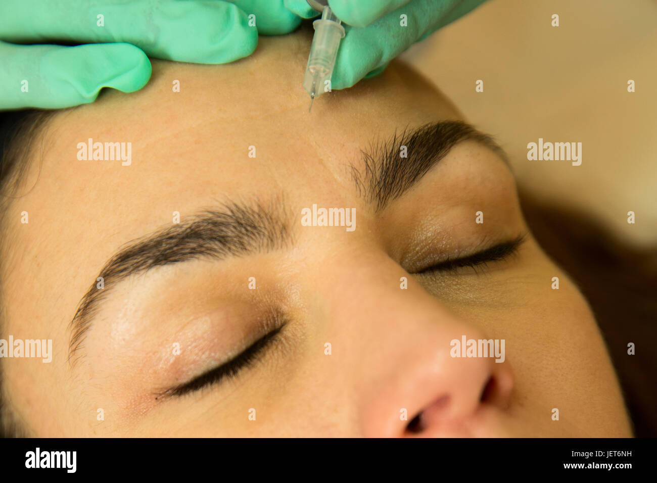 Mesotherapy hi-res stock photography and images - Alamy
