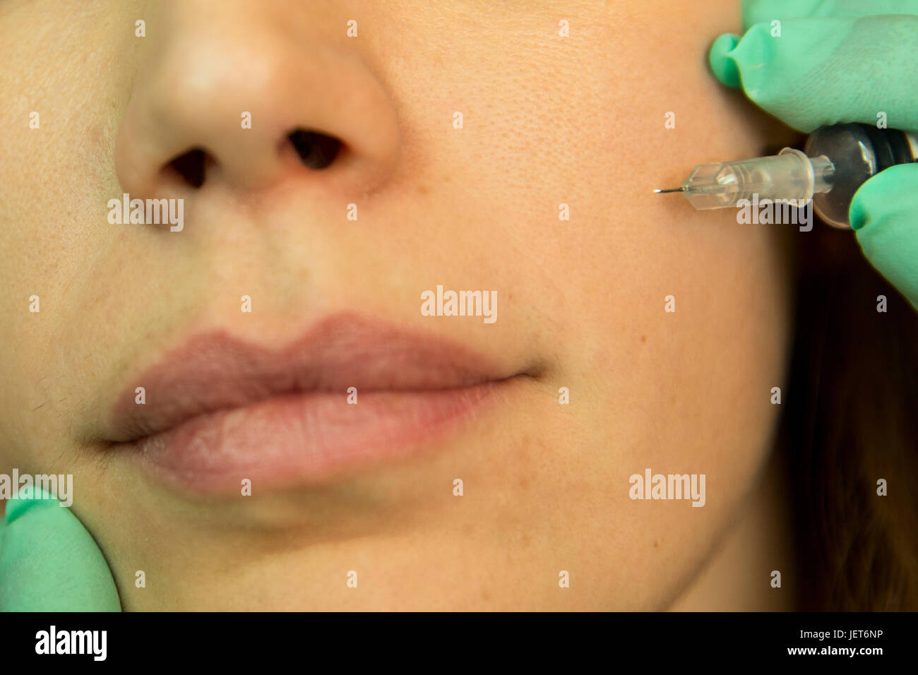 Mesotherapy hi-res stock photography and images - Alamy