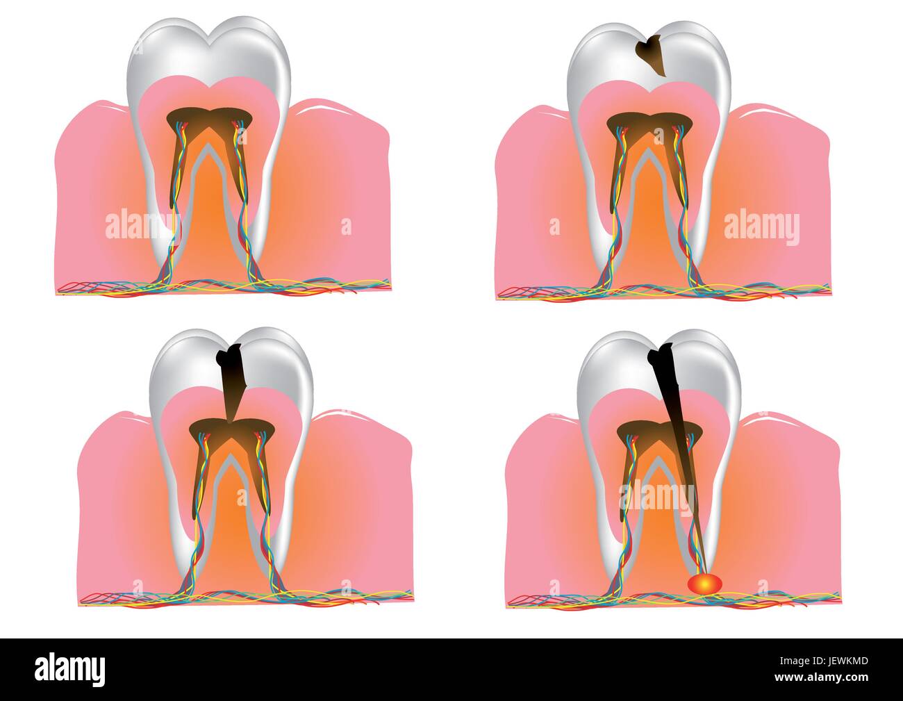 inside, isolated, teeth, human, human being, root, tooth, hygiene ...