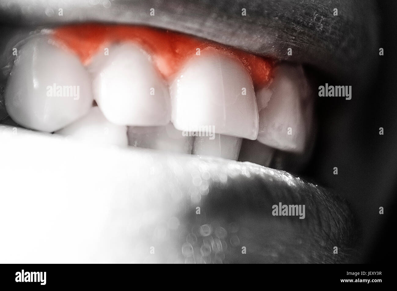 Bleeding gums hi-res stock photography and images - Alamy