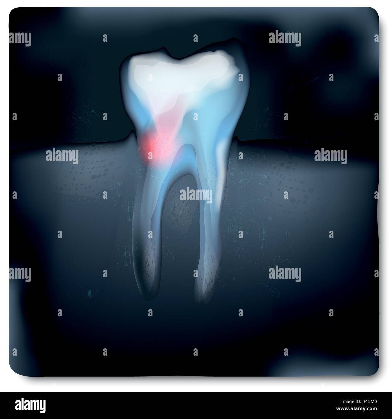 Dental radiograph Stock Vector Images - Alamy