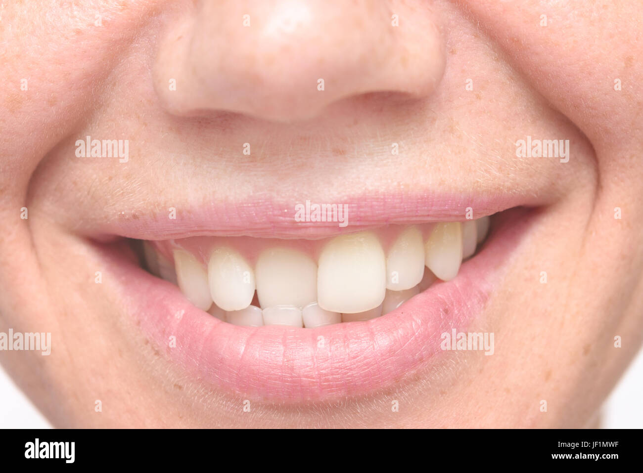 Crooked teeth hi-res stock photography and images - Alamy