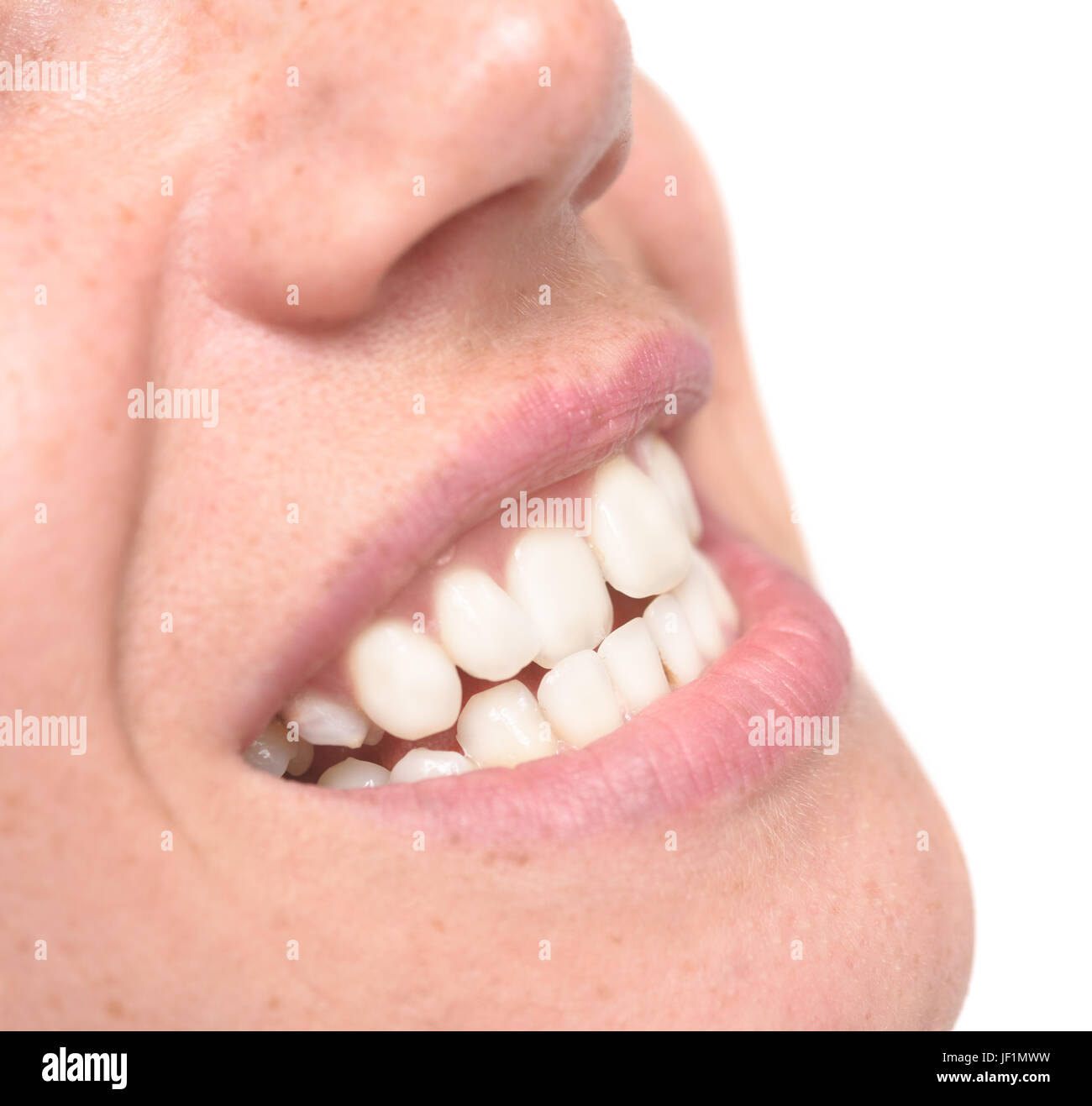 Crooked teeth hi-res stock photography and images - Alamy
