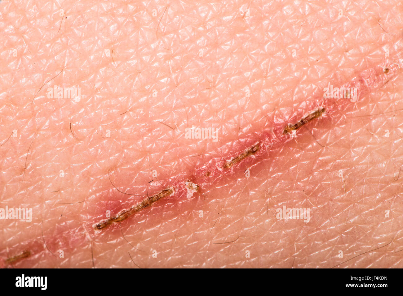 Texture of human skin and scratch Stock Photo - Alamy