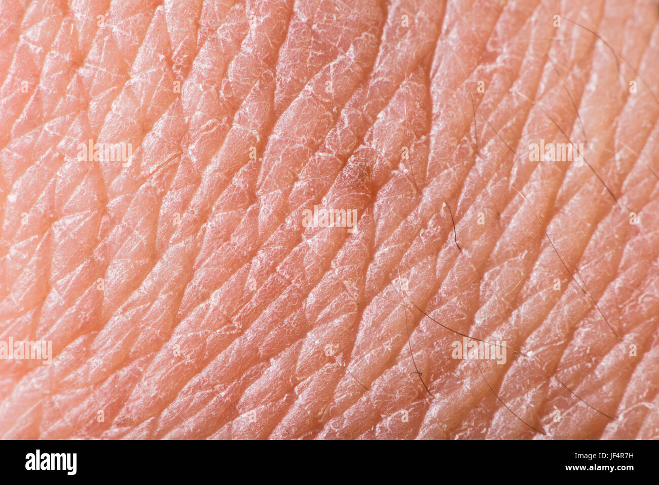Texture of human skin Stock Photo - Alamy