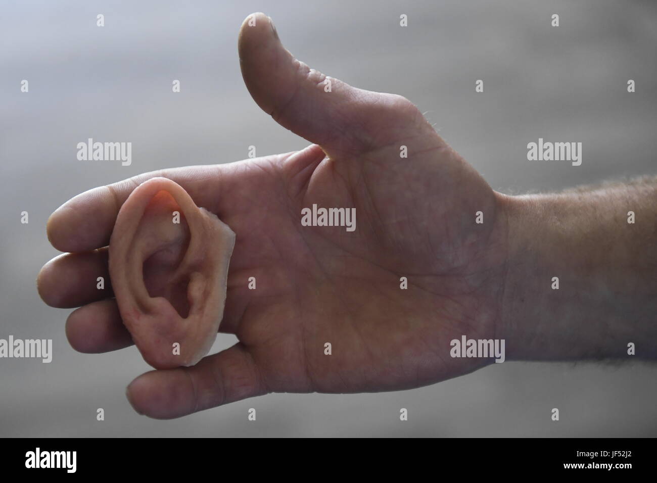 Prosthetic Body Part High Resolution Stock Photography and Images - Alamy