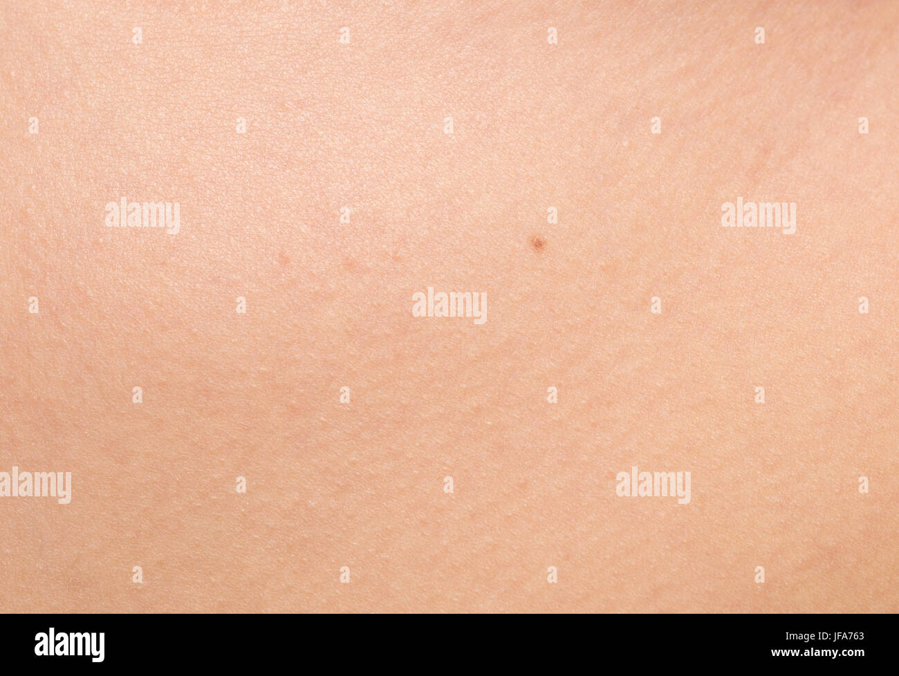 Dappled skin hi-res stock photography and images - Alamy