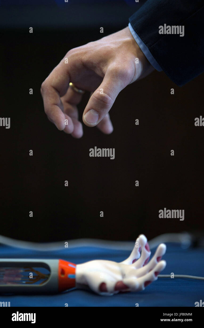 A soft prosthetic hand from the Queen Mary, University of London on ...