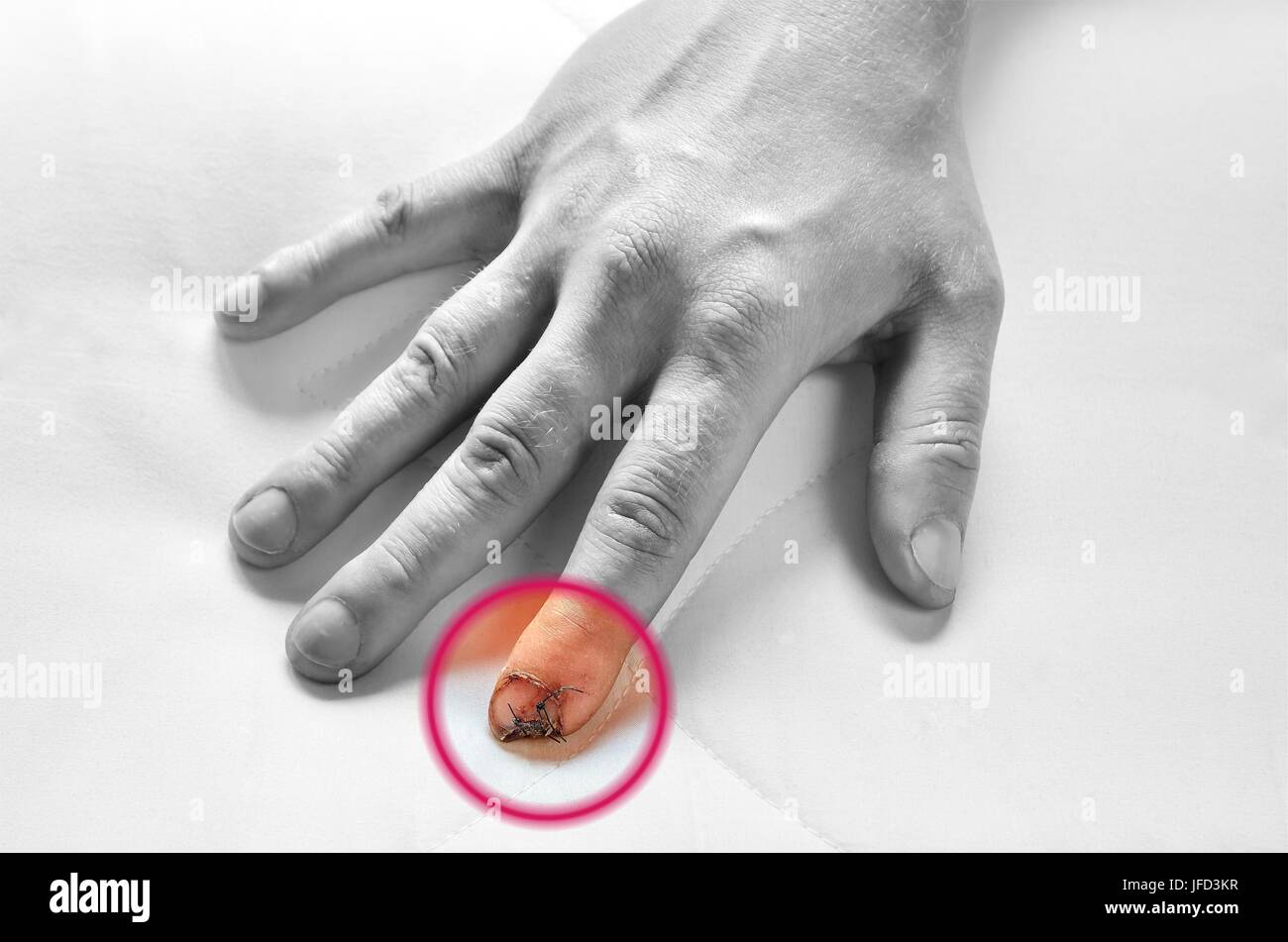 Man sore finger hi-res stock photography and images - Alamy