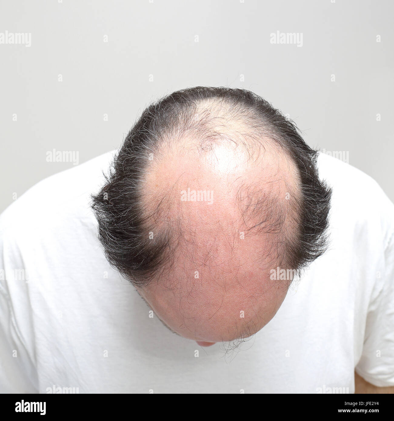 Bald head top hi-res stock photography and images - Alamy