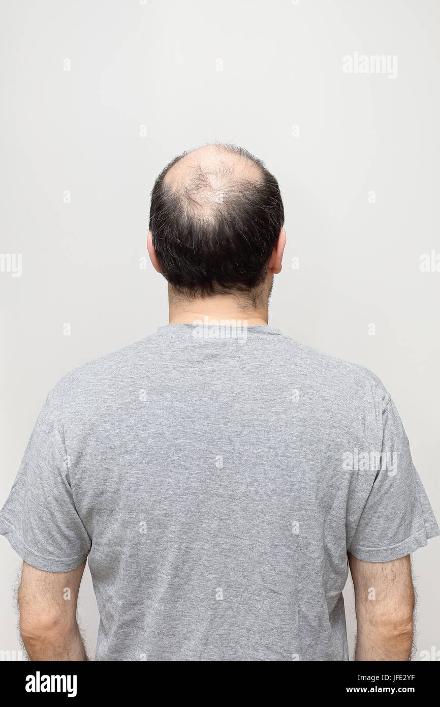 Bald head back of hi-res stock photography and images - Alamy