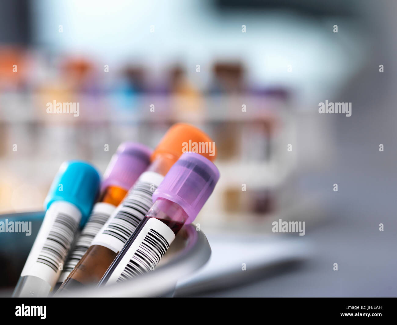 Tray of human medical samples awaiting clinical testing in a laboratory ...