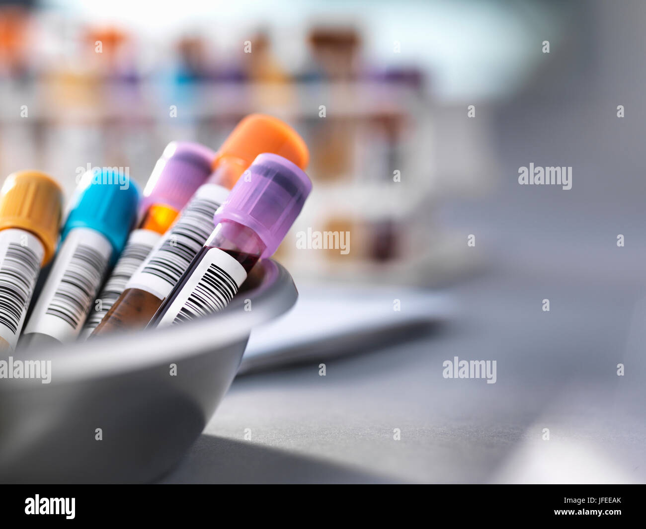 Tray of human medical samples awaiting clinical testing in a laboratory ...