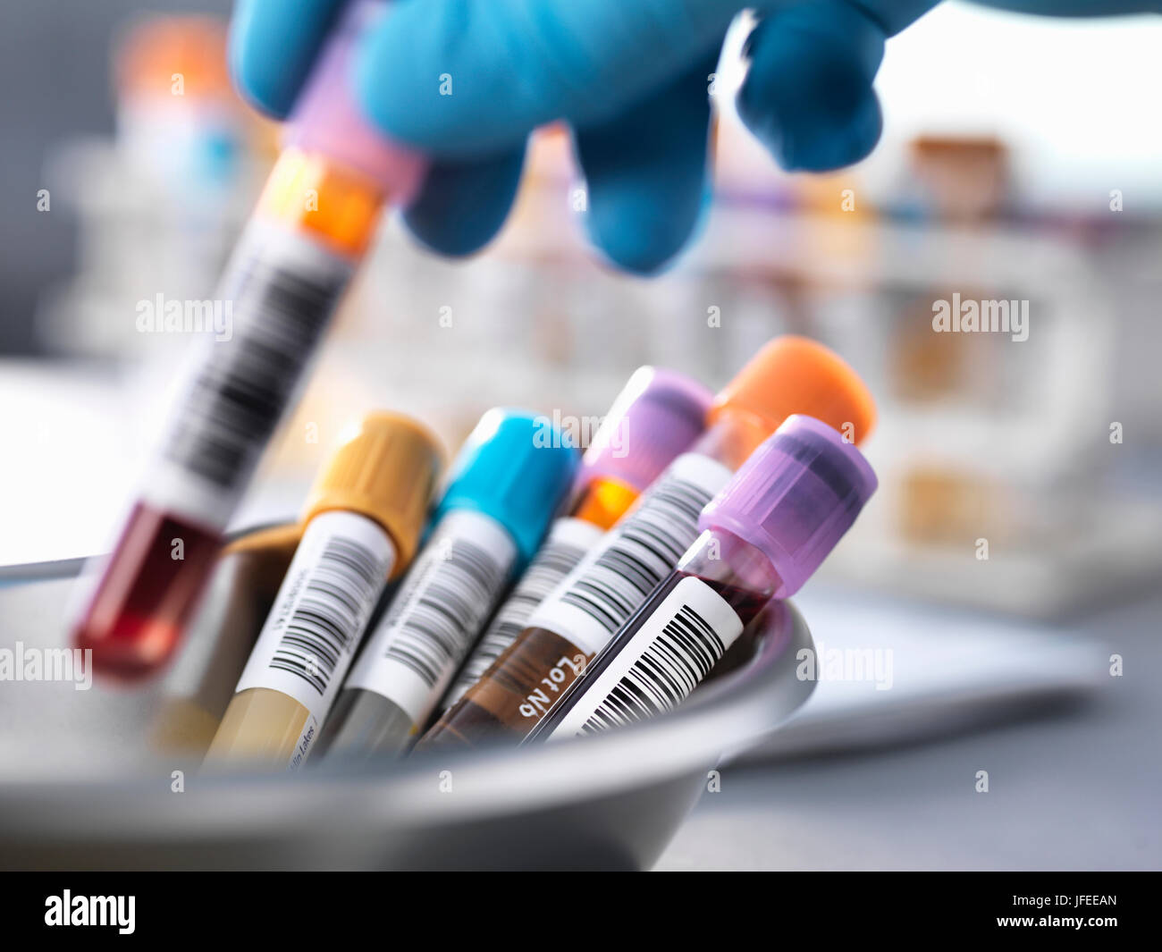 Scientist holding a blood sample with medical samples in a tray ...