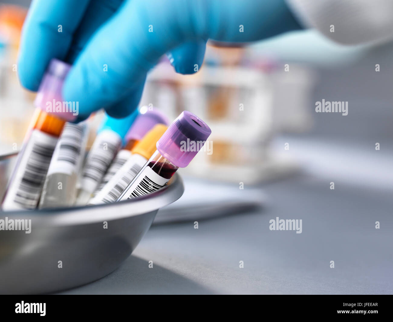 Scientist holding a blood sample with medical samples in a tray ...