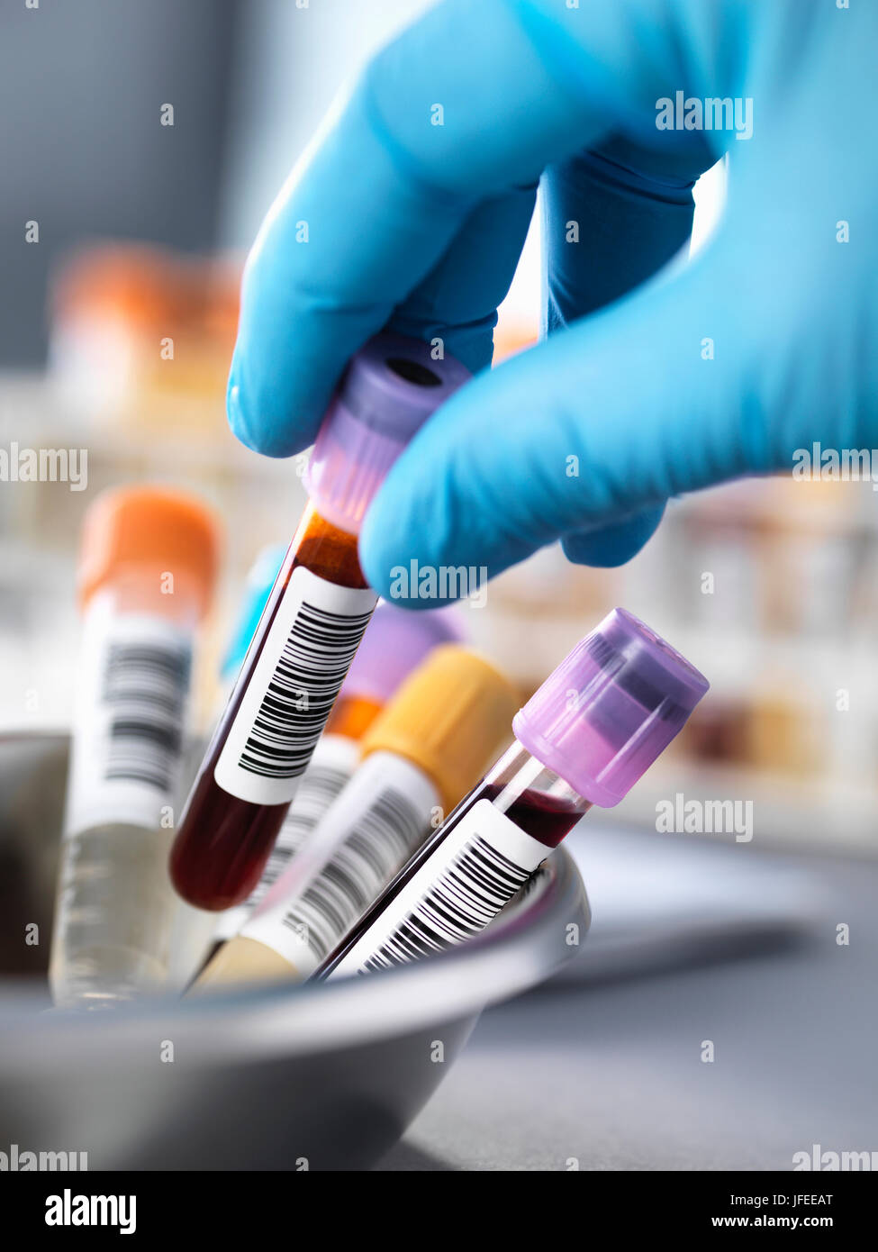 Scientist holding a blood sample with medical samples in a tray ...