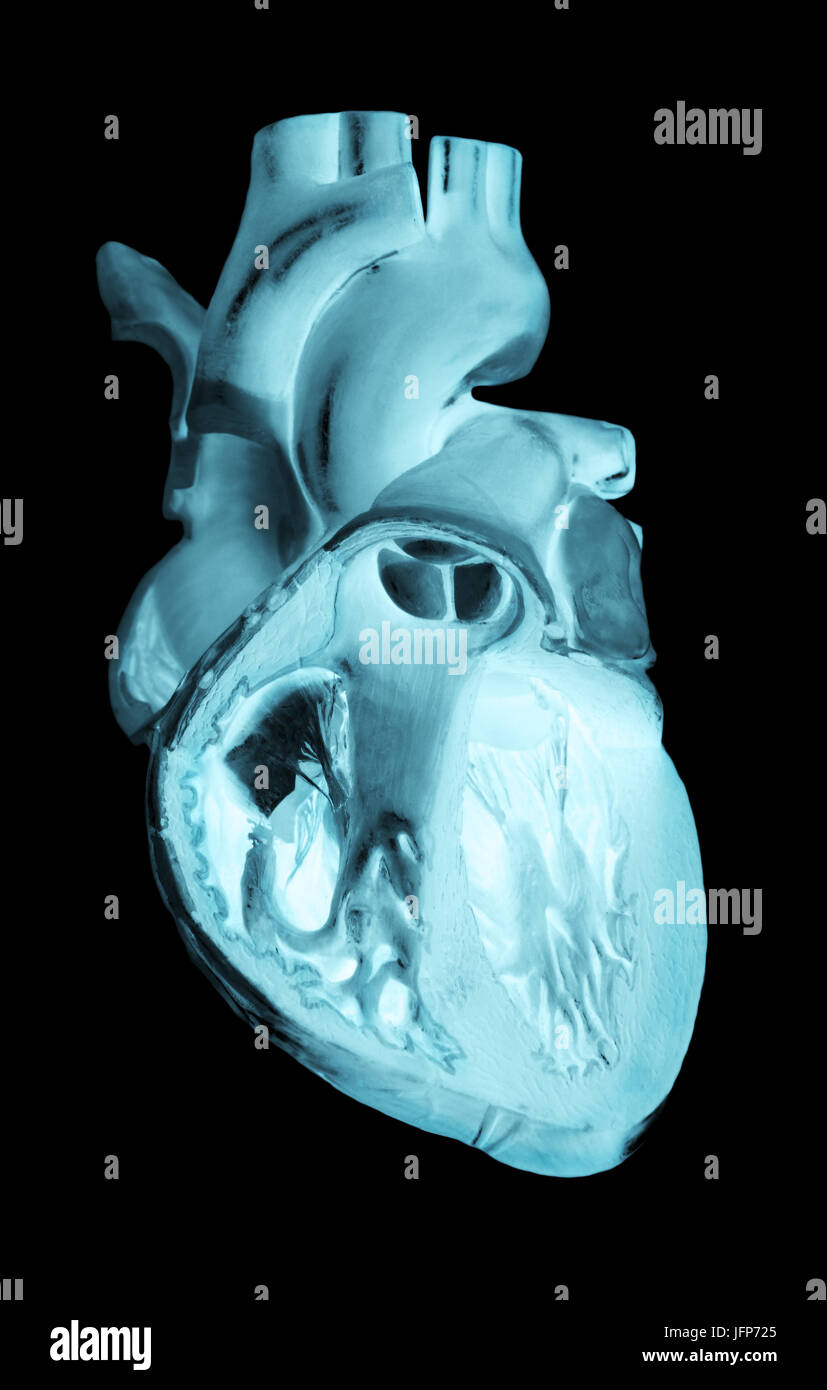 Negative 3D illustration radiograph of a human heart Stock Photo - Alamy
