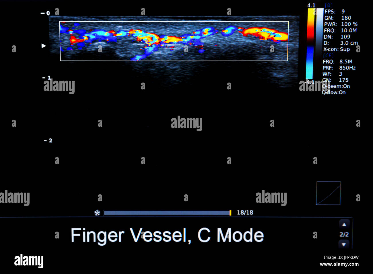 Colourful image of modern ultrasound monitor. Ultrasonography machine ...